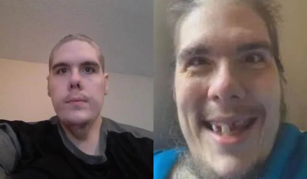 Debbie and Tony got engaged and started to plan for their wedding - usnews